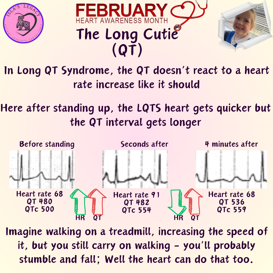 What happens to an LQTS heart? – The Long Cutie